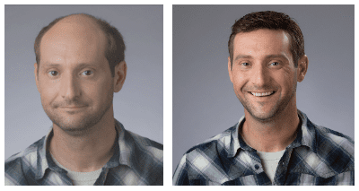 Hair Loss and Hair Thinning Solutions for Men & Women Today.